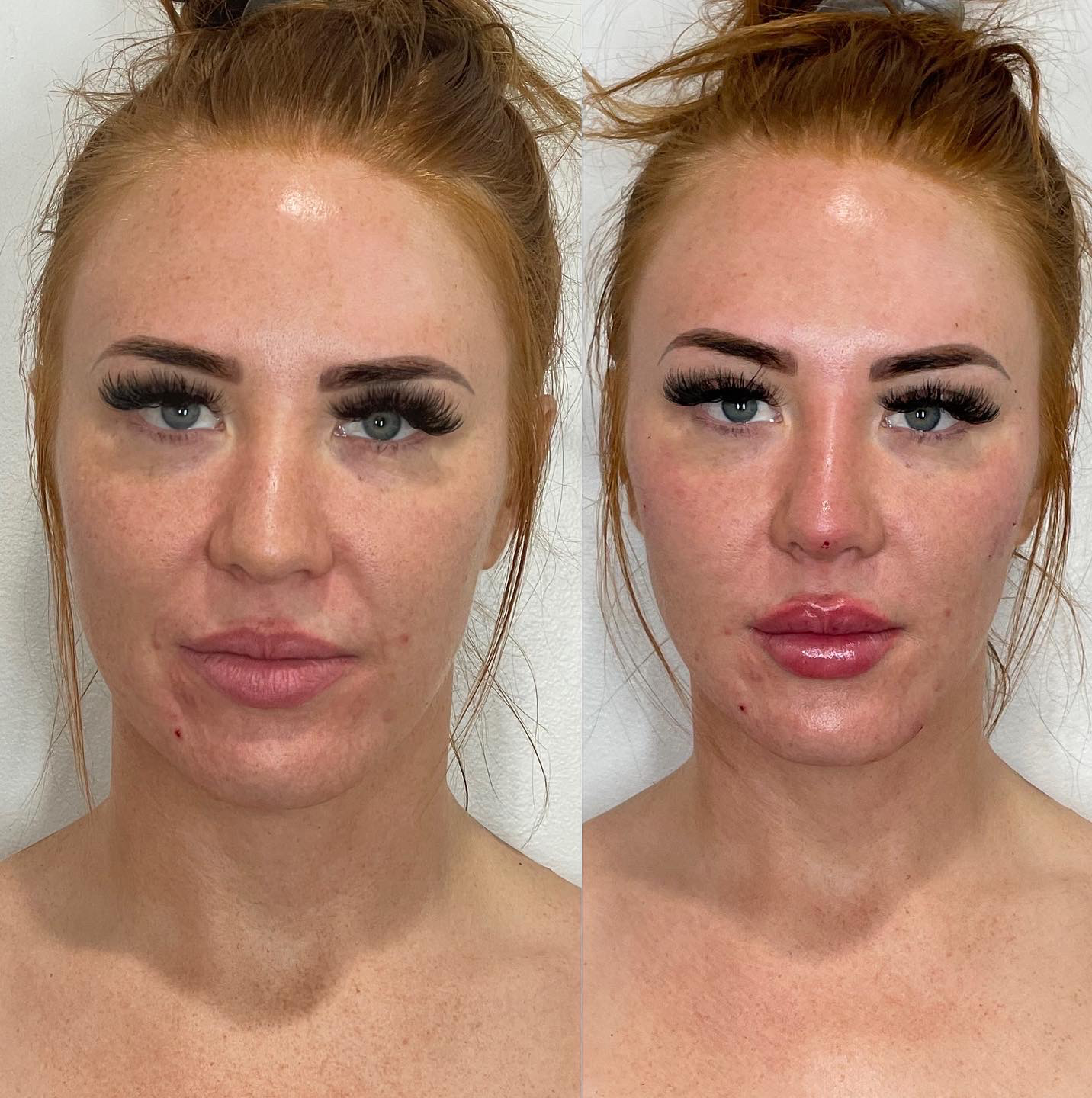 253028 Before and Afters | The Perfect Dose